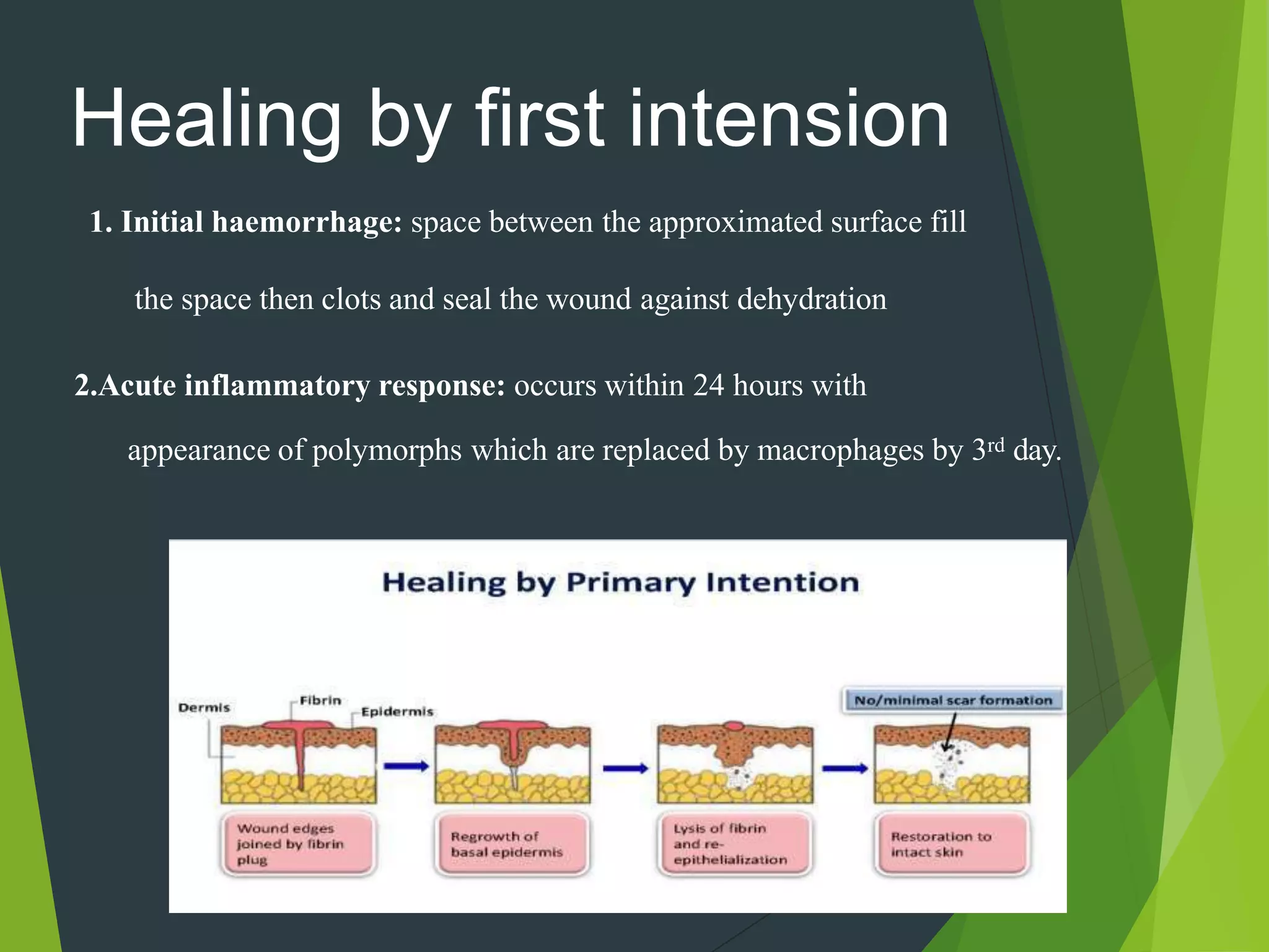 woundhealingandinflammation-181226163636 (1).pptx