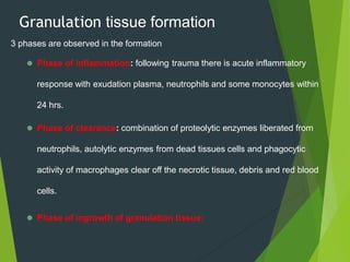 woundhealingandinflammation-181226163636 (1).pptx