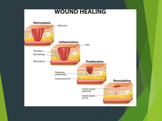 woundhealingandinflammation-181226163636 (1).pptx