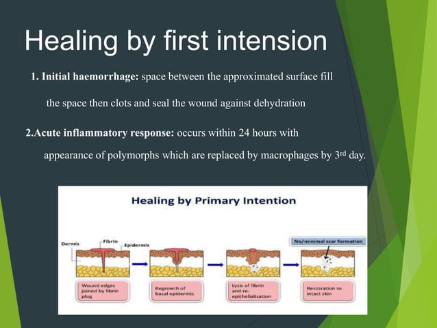 woundhealingandinflammation-181226163636 (1).pptx