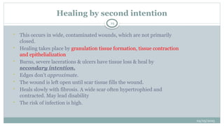 wound healing and principles of wound care.pptx