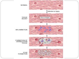 Wound healing and repair Repair/Healing : restoration of tissue ...