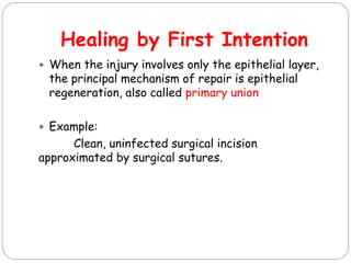 Wound healing and repair Repair/Healing : restoration of tissue ...
