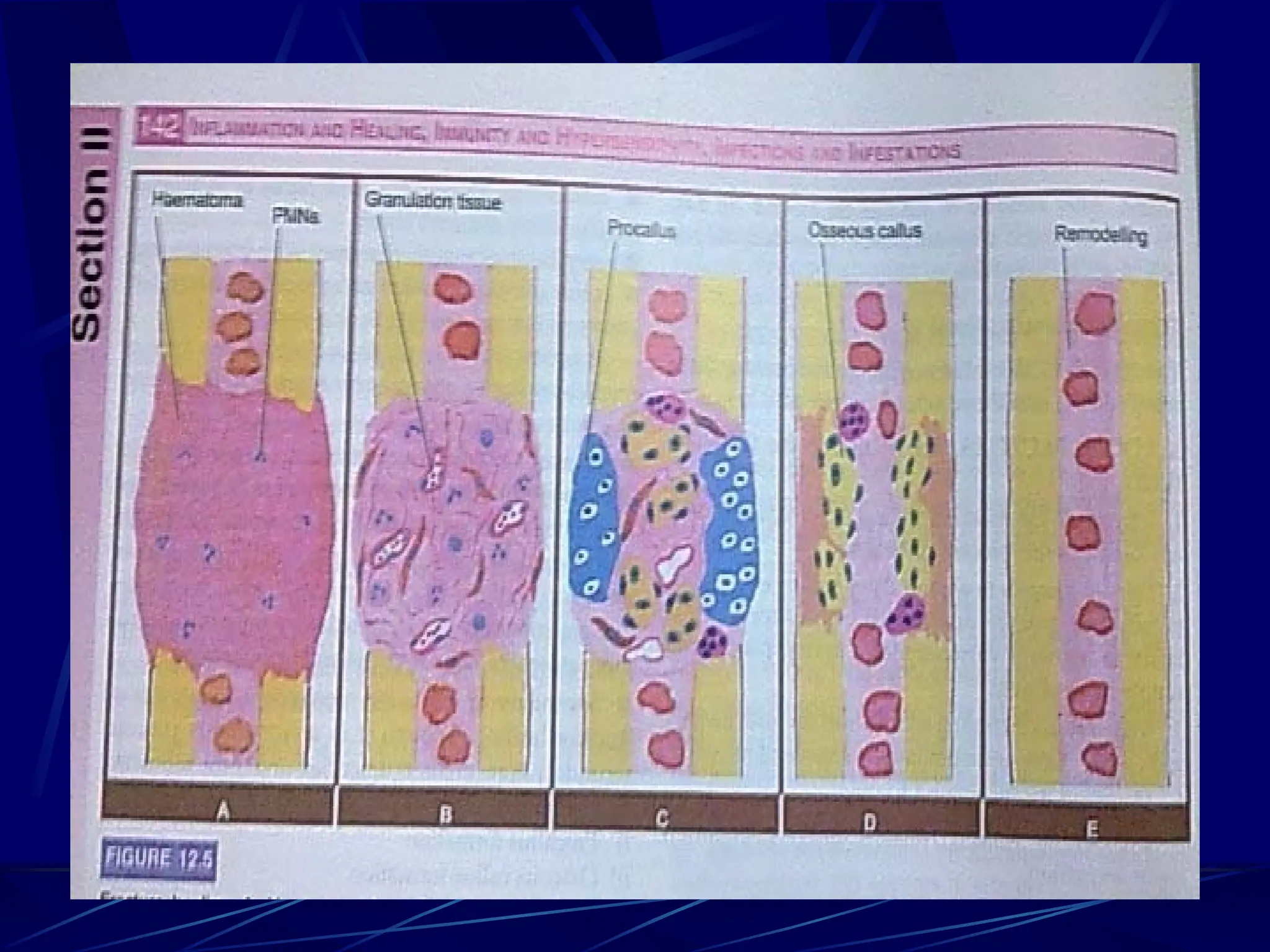 WOUND HEALING AND REPAIR OF TISSUES.ppt