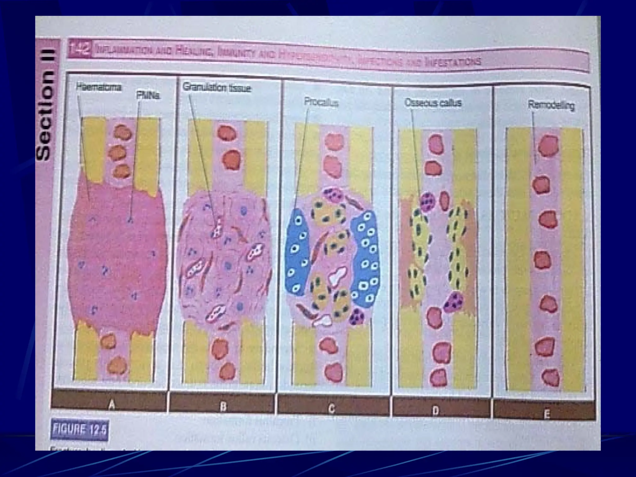 WOUND HEALING AND REPAIR OF TISSUES.ppt