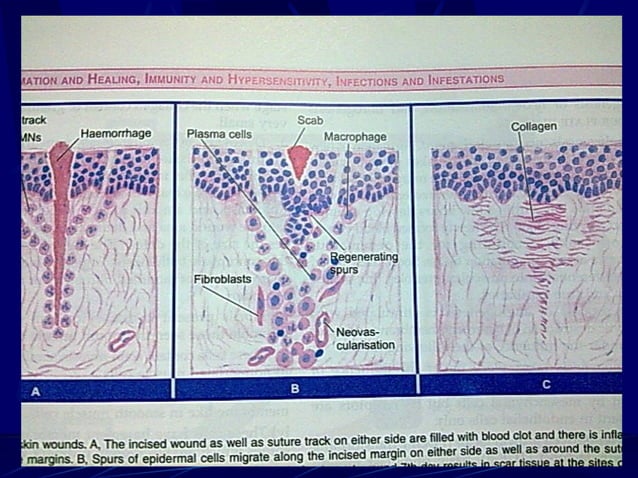 WOUND HEALING AND REPAIR OF TISSUES.ppt
