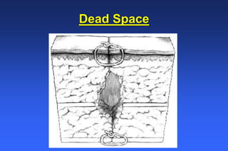 Wound_Healing_and_Suture_Knowledge-Kim_Bayer.ppt