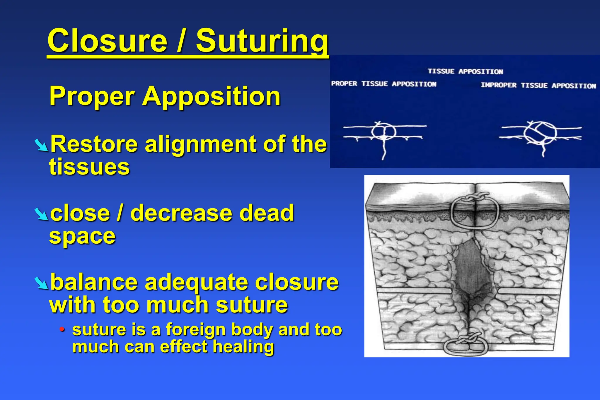 Wound Healing and Suture Knowledge-Kim_Bayer.ppt