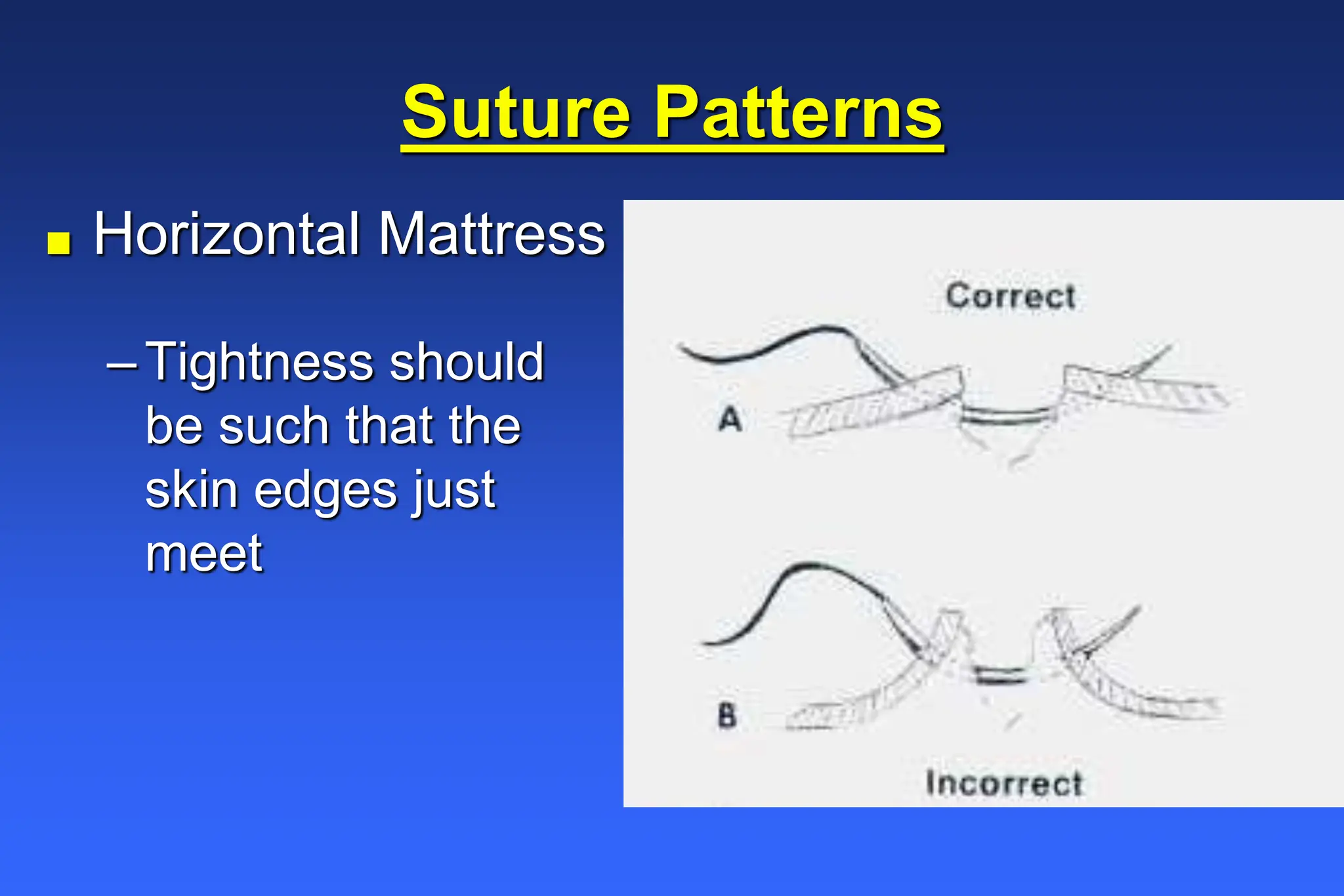 Wound Healing and Suture Knowledge-Kim_Bayer.ppt