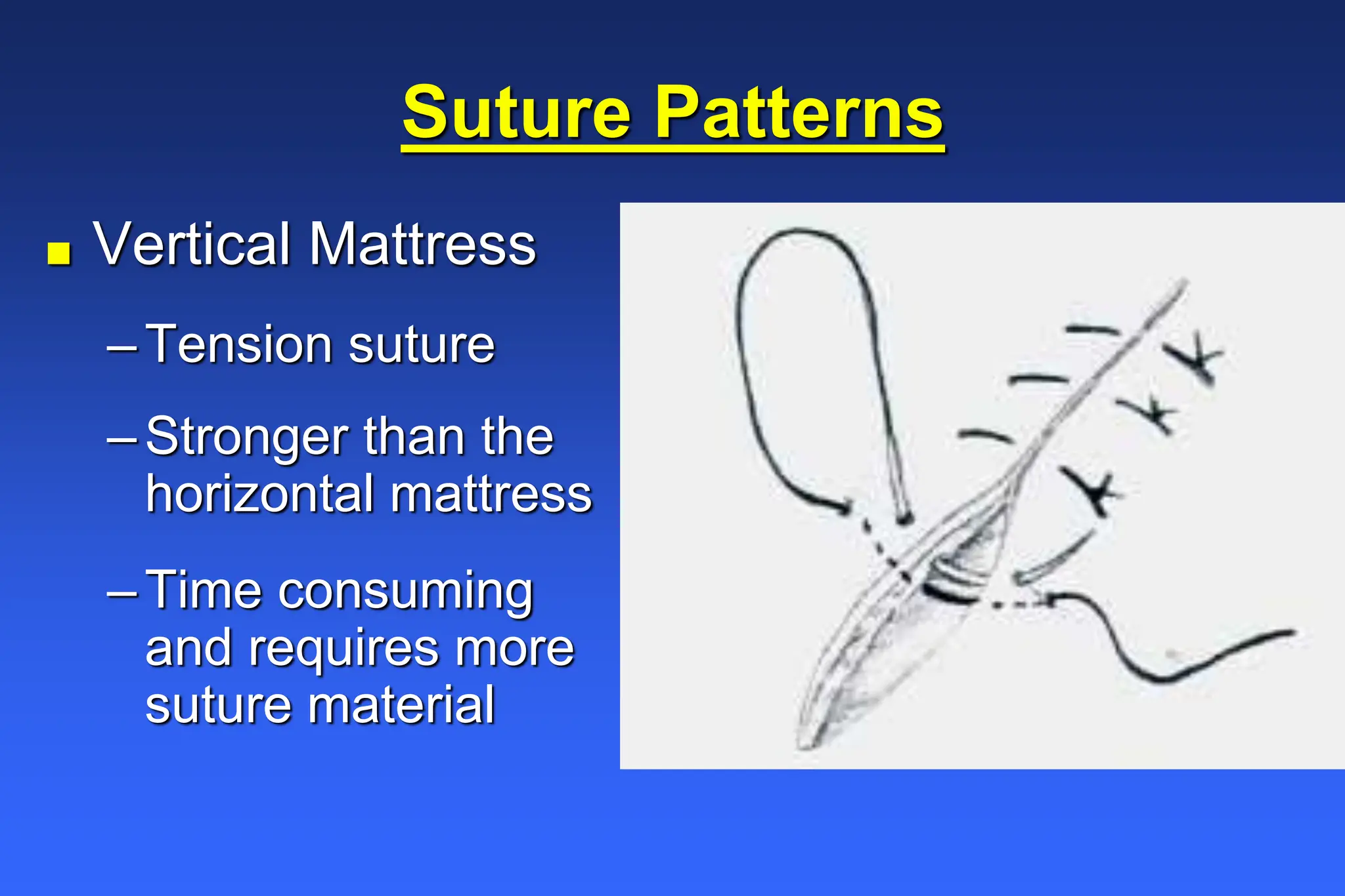 Wound Healing and Suture Knowledge-Kim_Bayer.ppt
