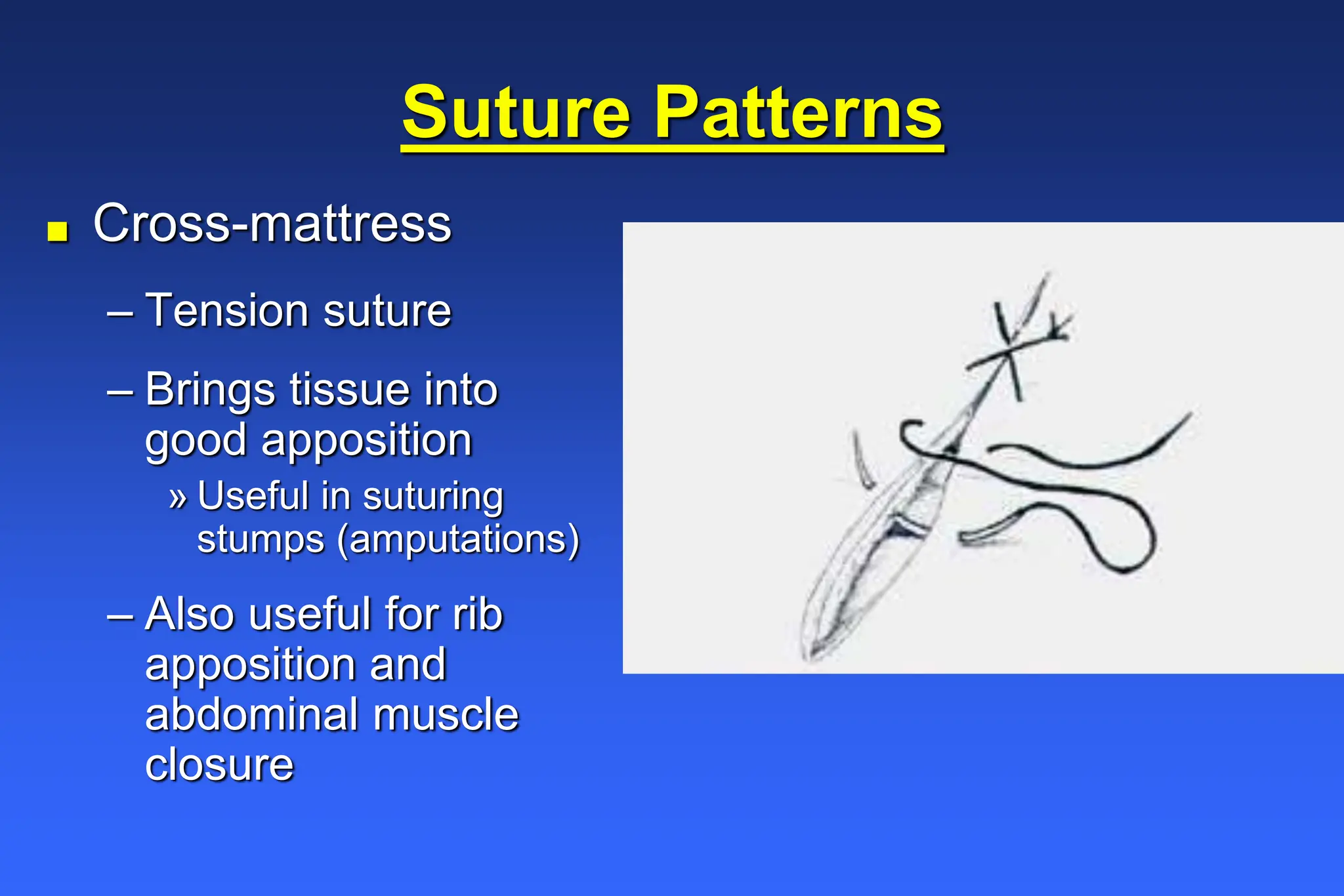 Wound Healing and Suture Knowledge-Kim_Bayer.ppt
