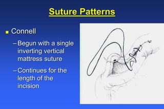 Wound Healing and Suture Knowledge-Kim_Bayer.ppt