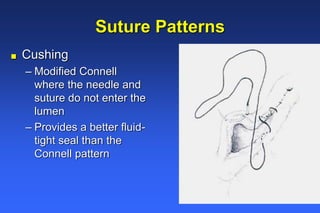 Wound Healing and Suture Knowledge-Kim_Bayer.ppt