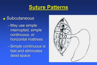 Wound Healing and Suture Knowledge-Kim_Bayer.ppt