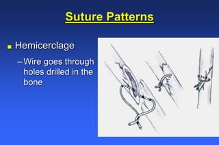 Wound Healing and Suture Knowledge-Kim_Bayer.ppt