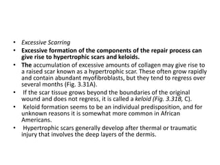 wound healing and wound care.pptx