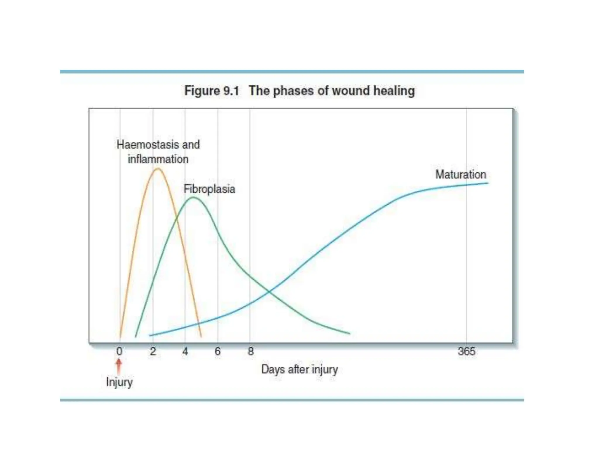 wound healing , factors affectings and wound management | PPTX