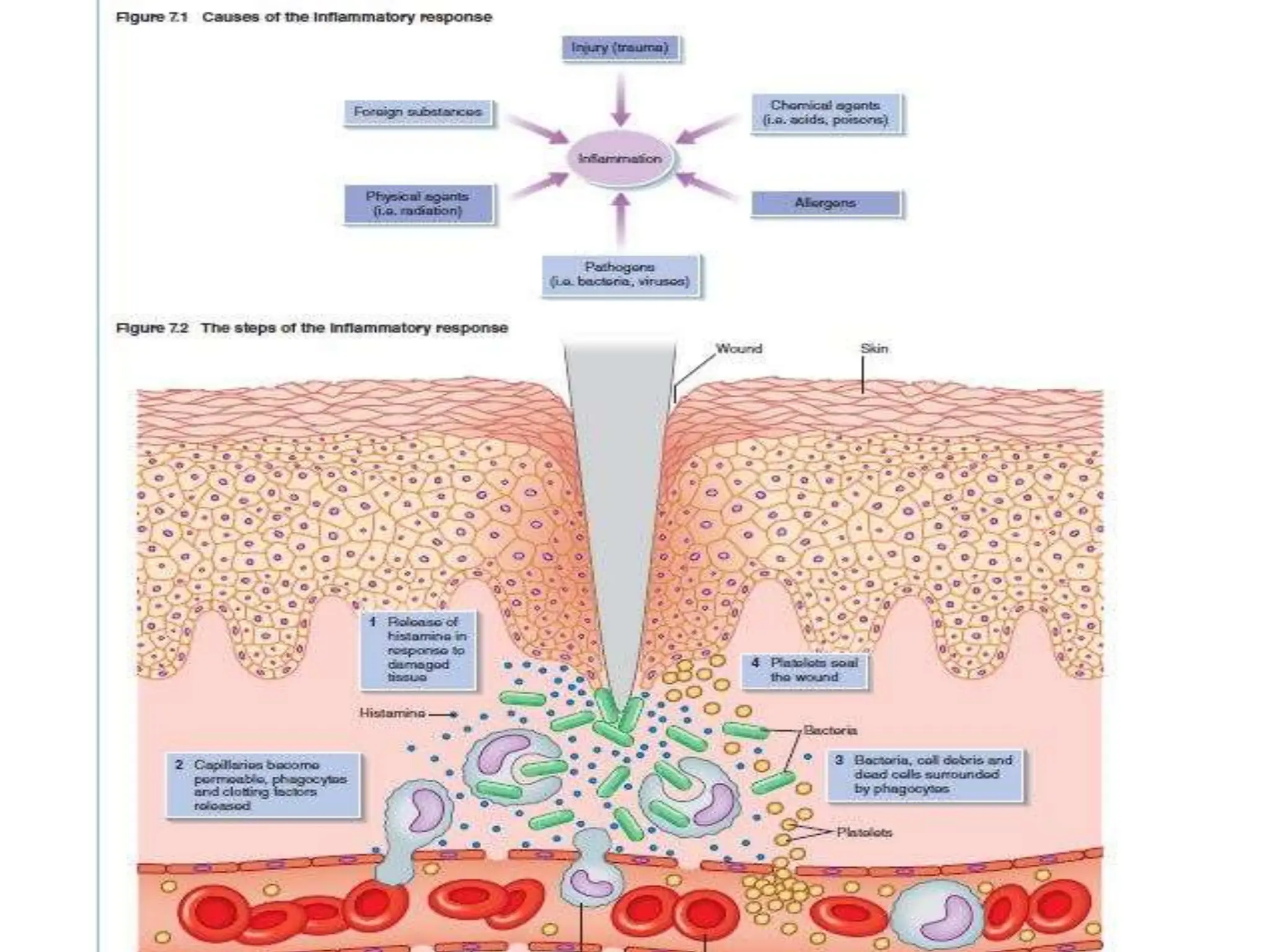 wound healing , factors affectings and wound management | PPTX