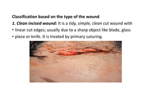 wound healing [Autosaved].pptx