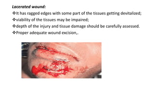 wound healing [Autosaved].pptx