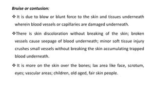 wound healing [Autosaved].pptx