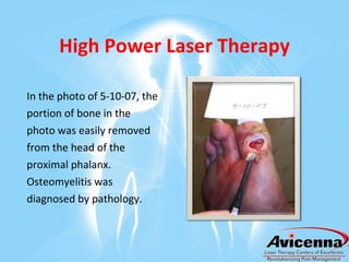Wound Healing Case Study—AvicennaLaser.com