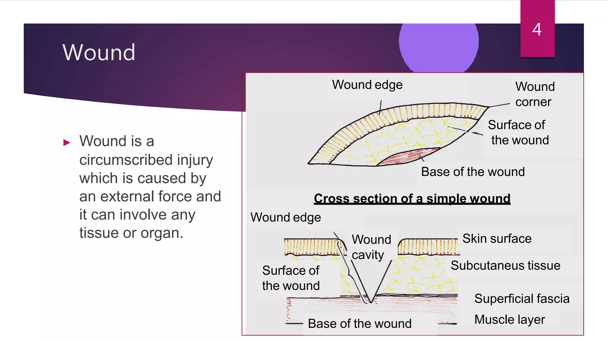woundhealing DMLT 2023.pptx