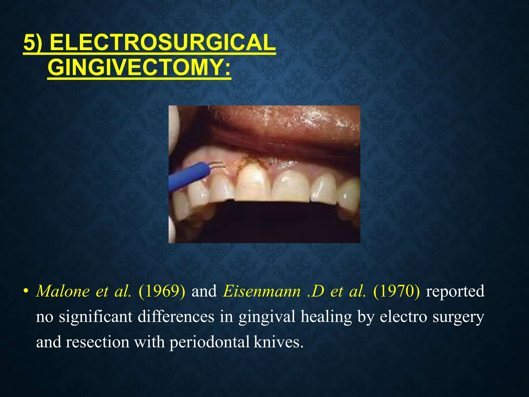 Wound Healing in Periodontology .pptx