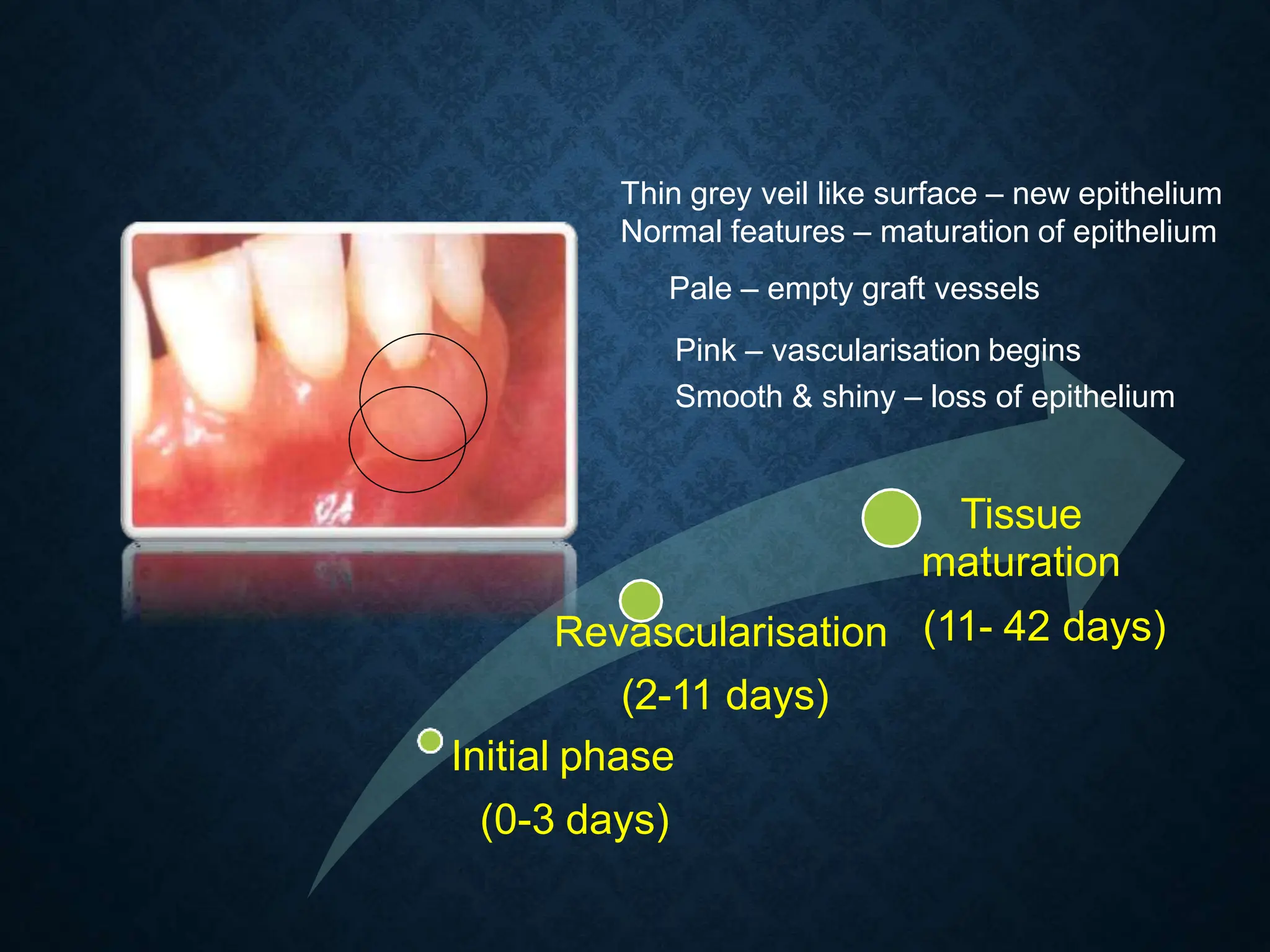 Wound Healing in Periodontology .pptx