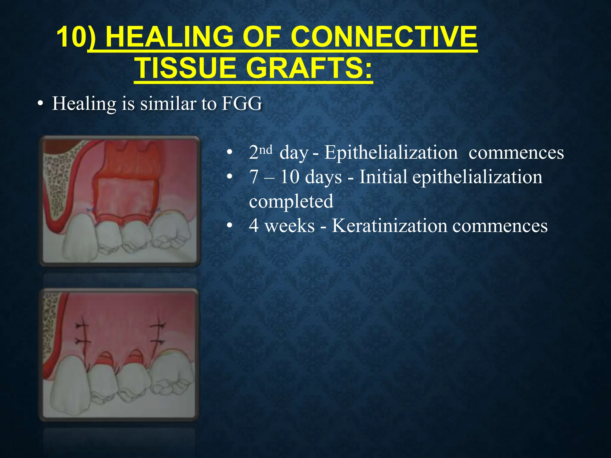 Wound Healing In Periodontology Pptx