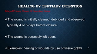 wound healing DR SINDHURA.pptx