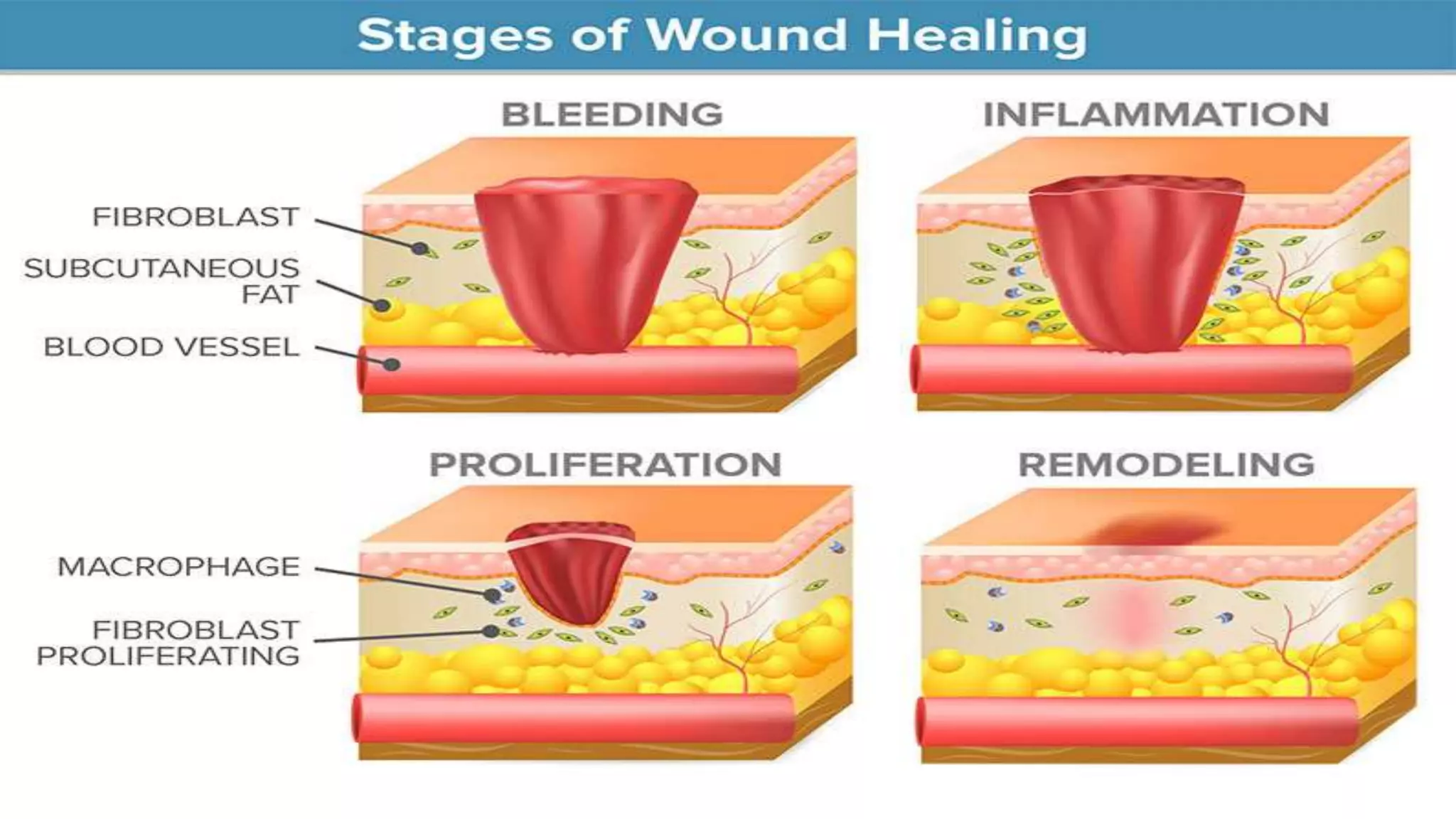 Wound Healing for UG.pptx
