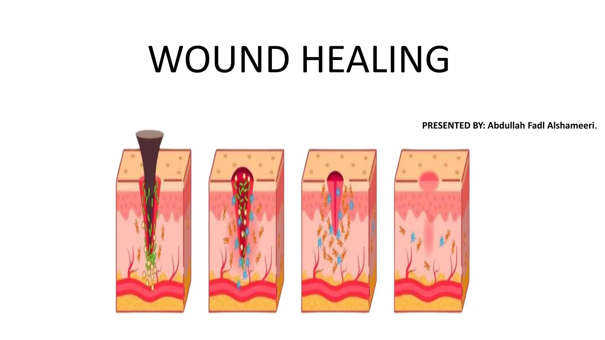 Wound_Healing_Full_Presentation and phases of wound healing.pdf