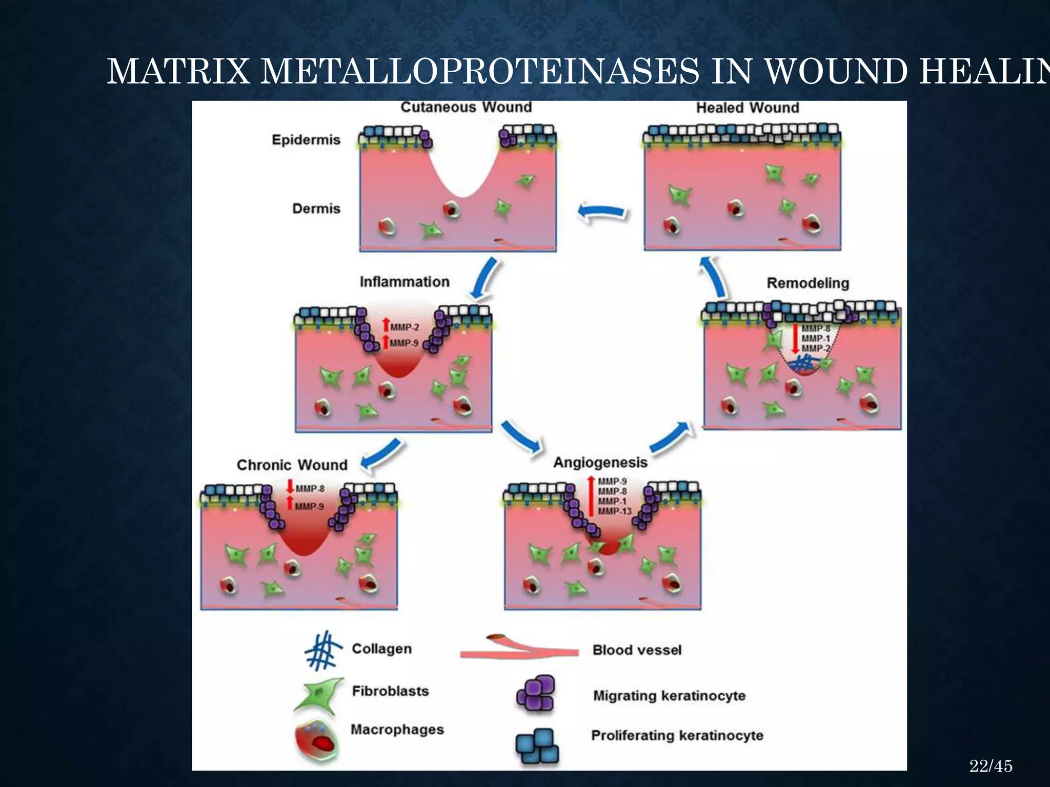 Wound healing in Perio - Dr. Malvika Thakur | PPTX
