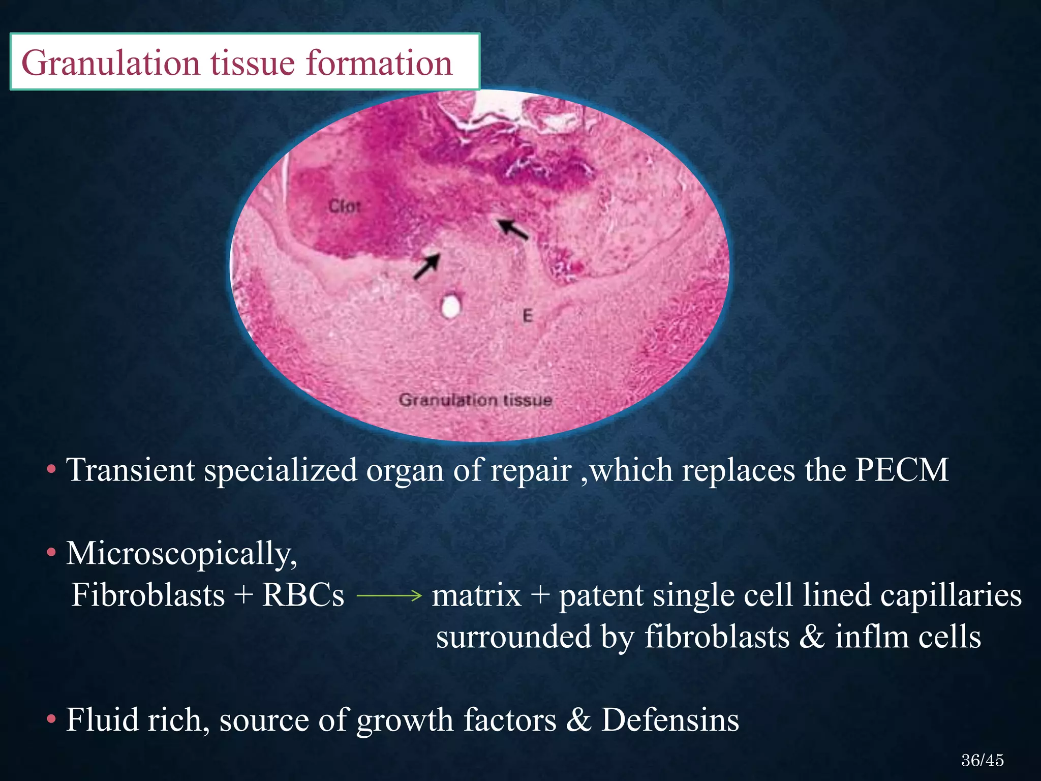 Wound healing in Perio - Dr. Malvika Thakur | PPTX