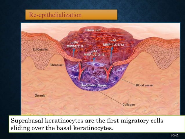 Wound healing in Perio - Dr. Malvika Thakur | PPTX | Skin and ...