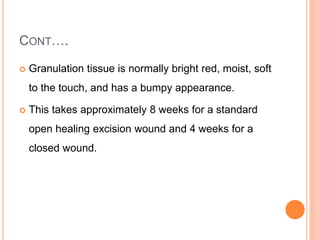 wound healing in secondary intention.pptx