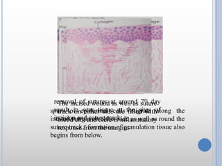 Wound healing [including healing after periodontal therapy] | PPTX