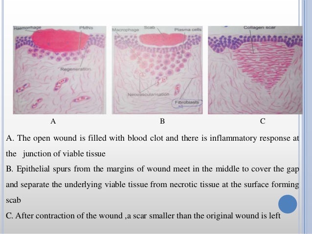 Wound healing [including healing after periodontal therapy]