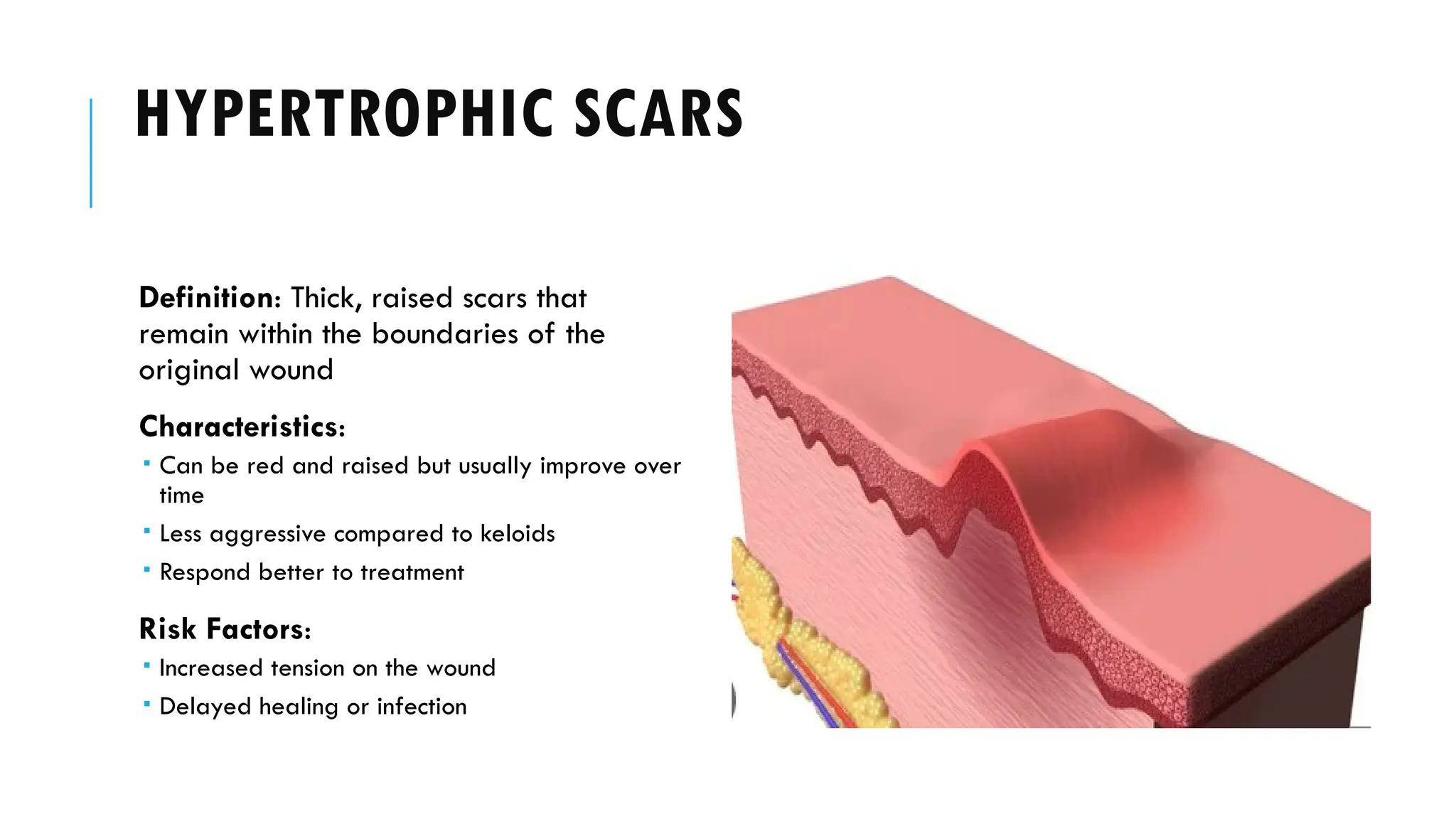 WOUND HEALING ,KELOIDS AND HYPERTROPHIC SCARS BY DR ABRAHAM.pptx