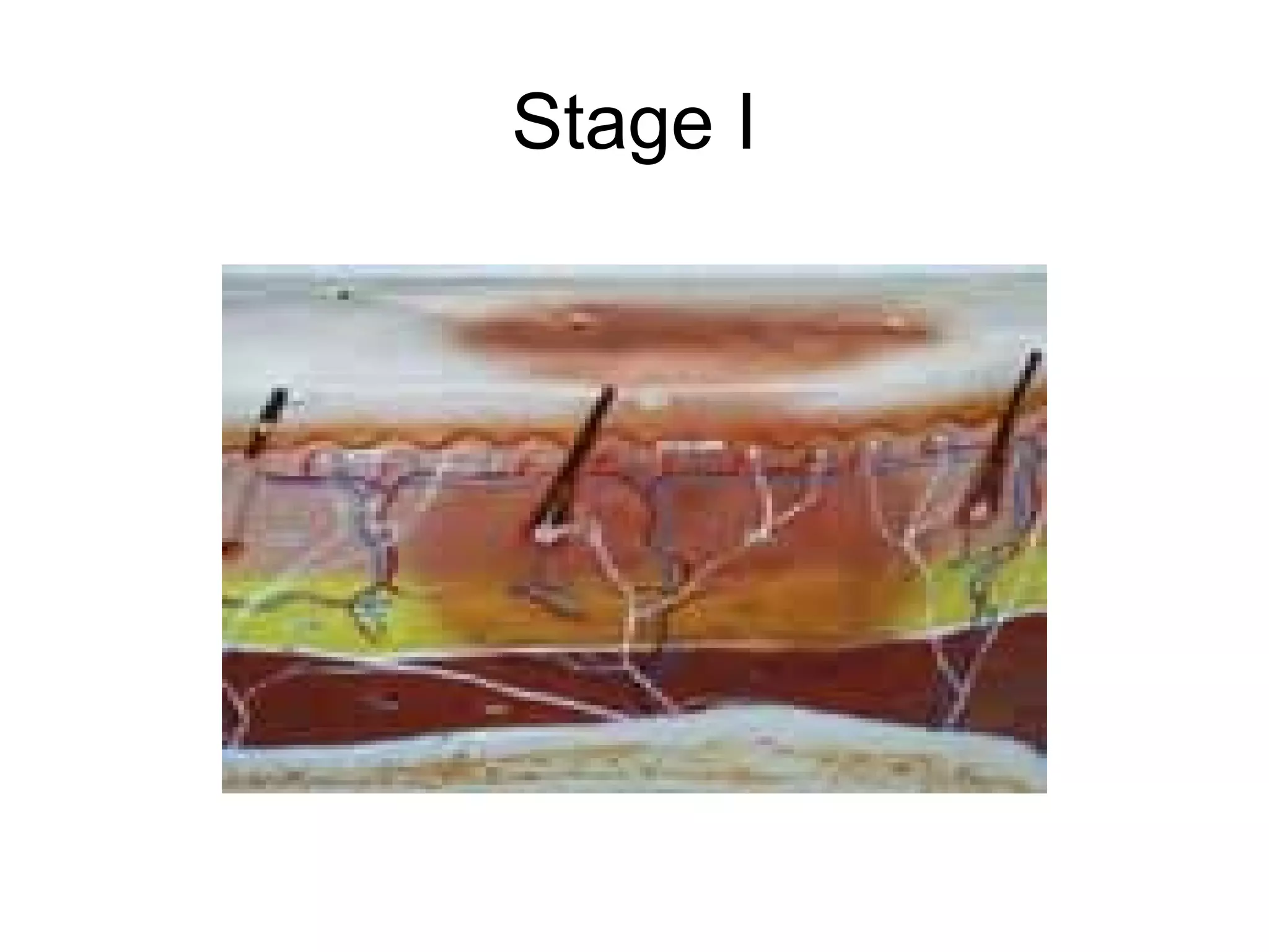 Wound healing lecture | PPT | First Aid | Injuries