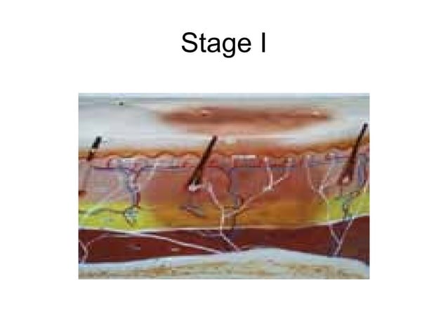 Wound healing lecture | PPT | First Aid | Injuries