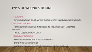 Wound healing ( MOHIT JANGRA).pptx
