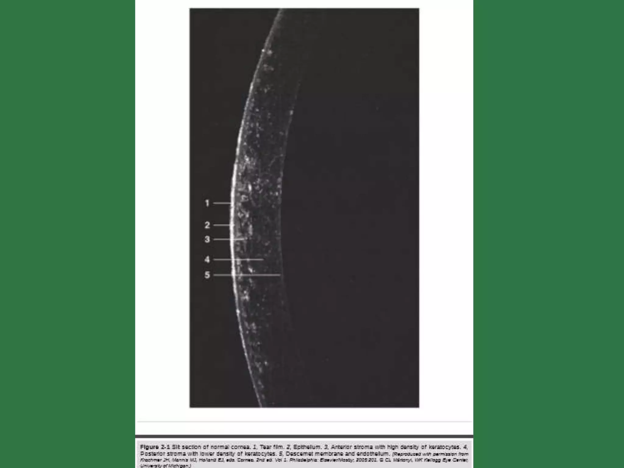 Wound healing of cornea | PPTX