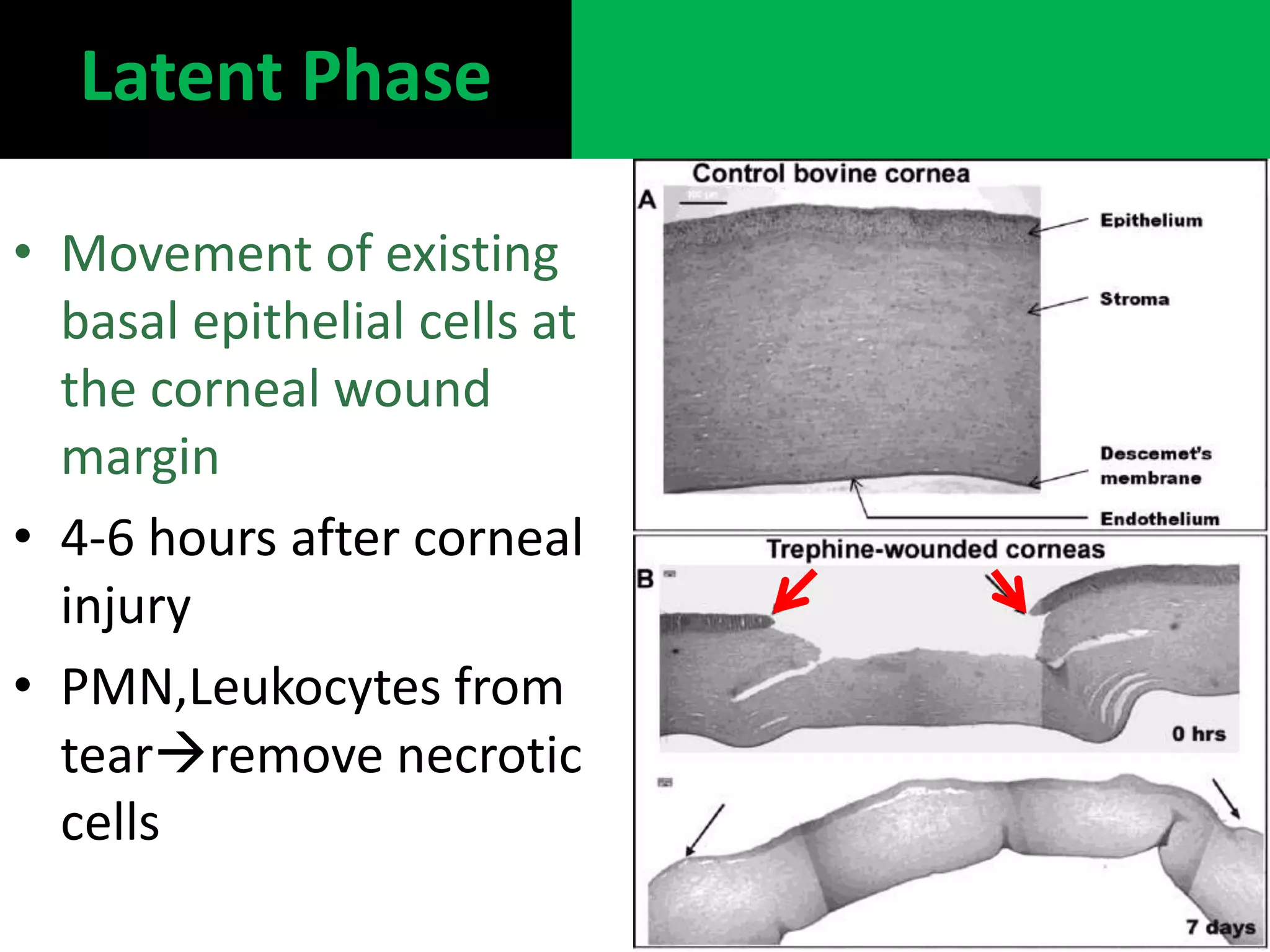 Wound healing of cornea | PPTX