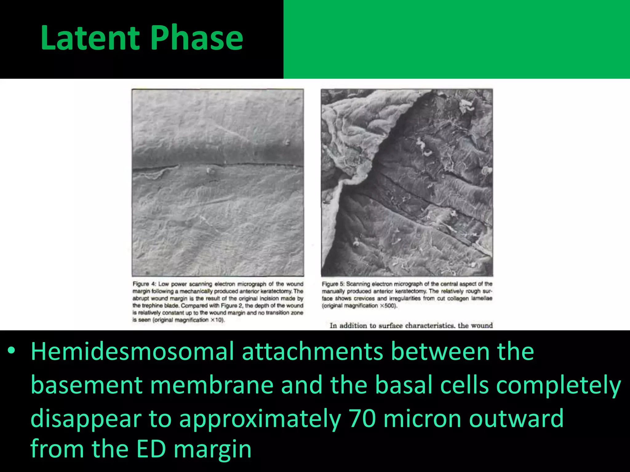 Wound healing of cornea | PPTX