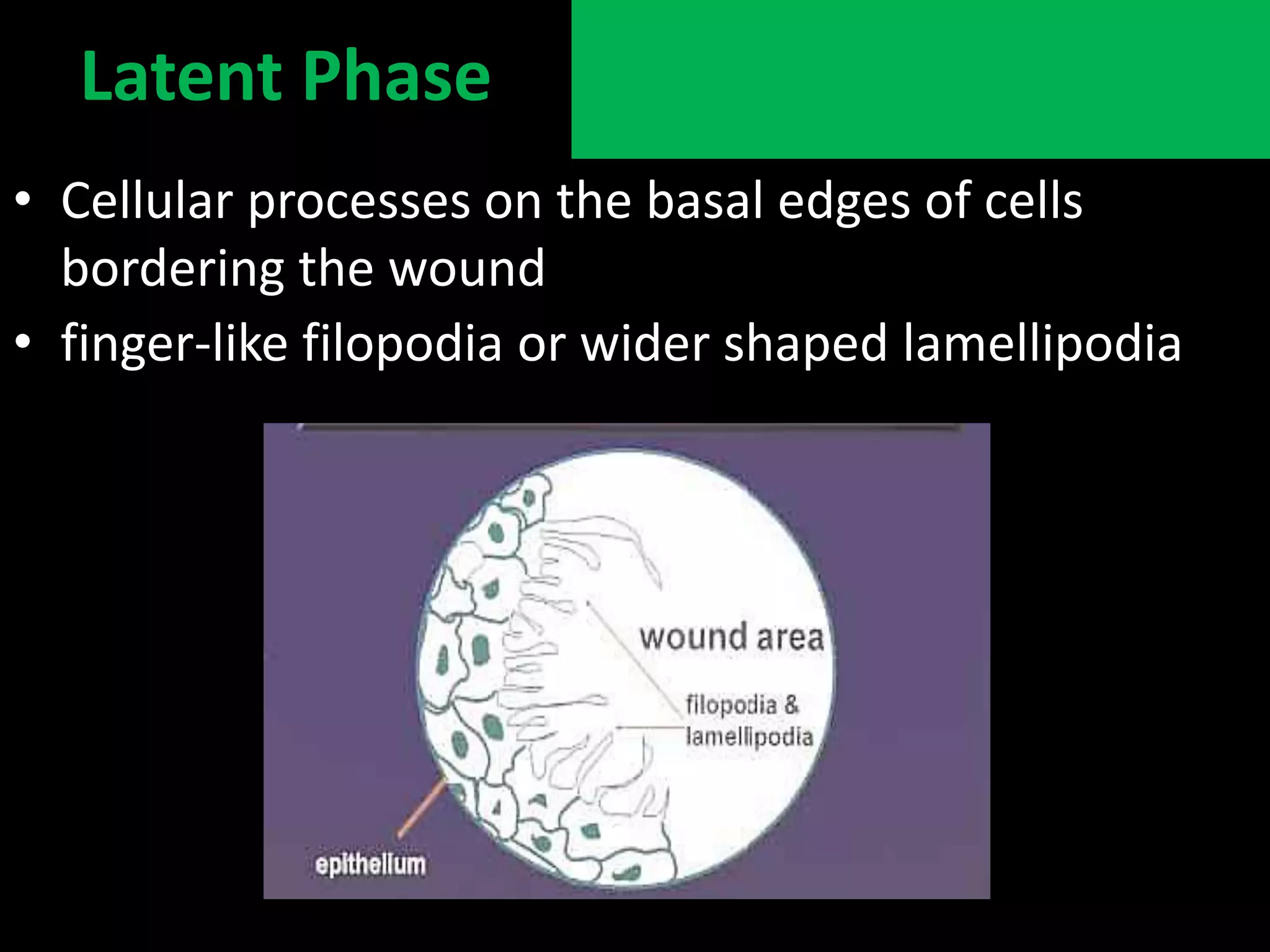Wound healing of cornea | PPTX
