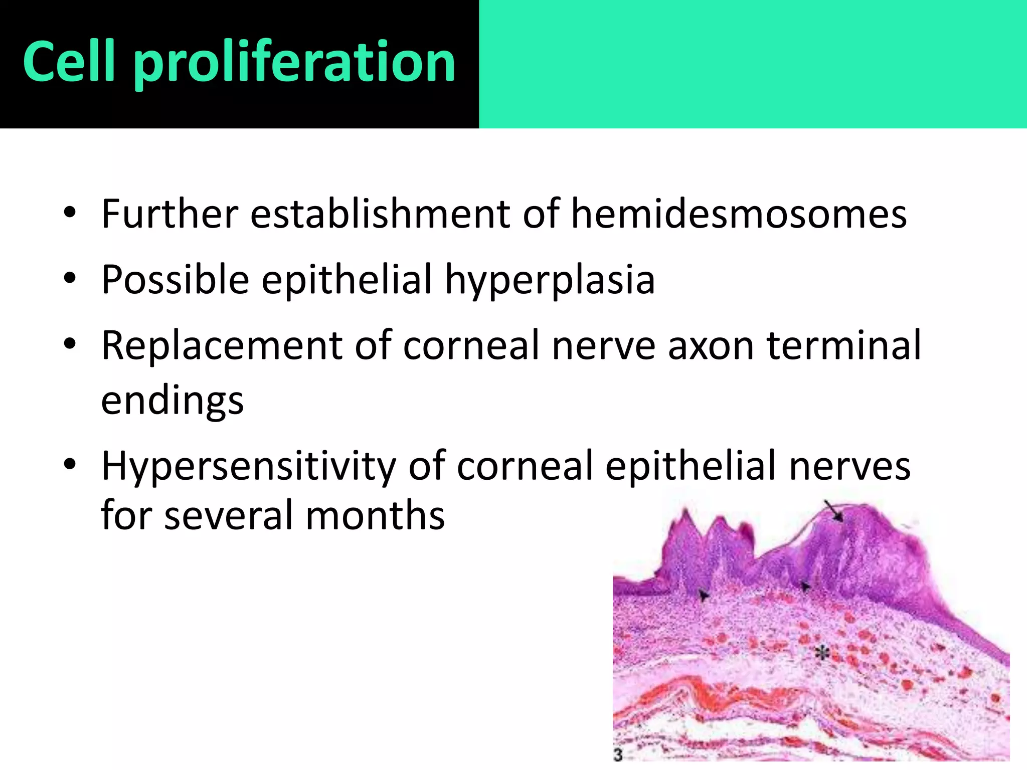 Wound healing of cornea | PPTX