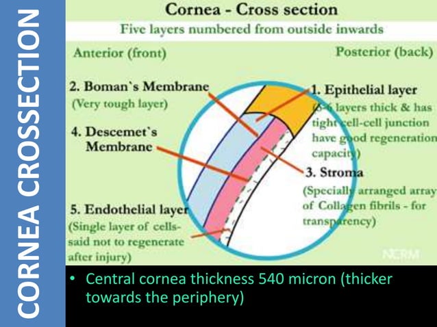 Wound healing of cornea | PPTX | Eye and Vision Conditions | Diseases ...