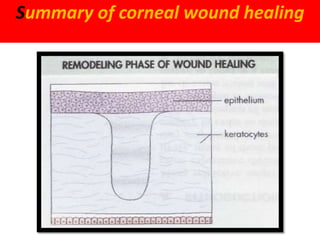 Wound healing of cornea | PPTX